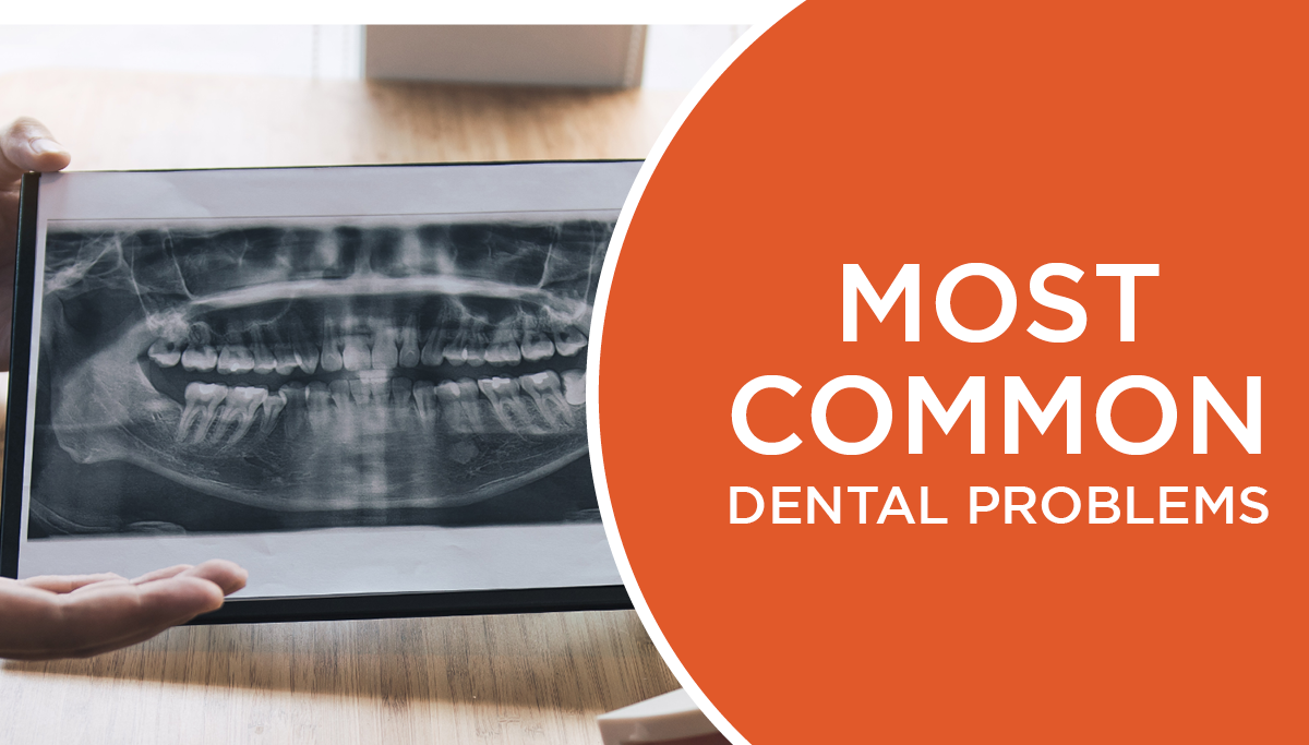 Most Common Dental Problems Most Common Dental Problems